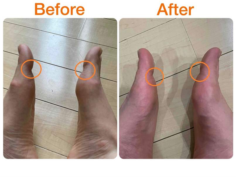 足刺激を始めたら体がデトックスをスタート！ 3週間で肩こりが軽くなったモニター実体験レポ|ダイエット、フィットネス、ヘルスケアのことならFYTTE-フィッテ