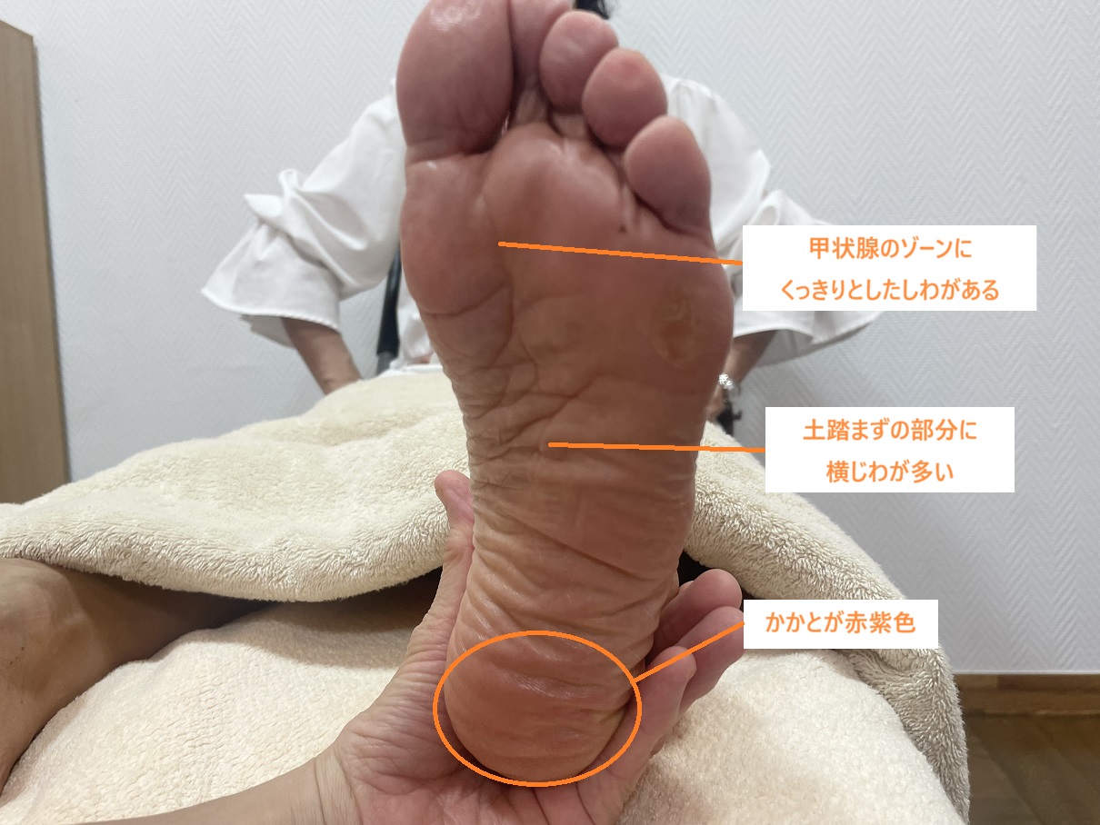 疲れやすい人は即実践して！ 内臓の働きを正常にして元気な体に導く足刺激テクニック|ダイエット、フィットネス、ヘルスケアのことならFYTTE-フィッテ