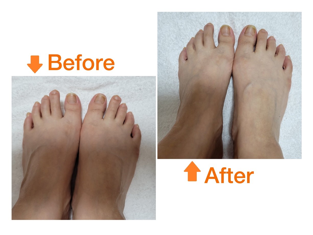 「疲れ目」をしっかりケアしたら、腰痛や肩こりが軽くなり、足の甲のむくみもスッキリ！ 普段の生活に変化をもたらした3週間のモニター体験|ダイエット、フィットネス、ヘルスケアのことならFYTTE-フィッテ