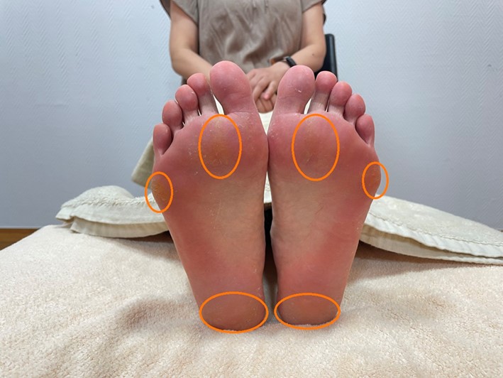 ツラい肩こり・腰痛は「眼精疲労」が原因のことも！ 疲れ目を解消する足刺激テクニック|ダイエット、フィットネス、ヘルスケアのことならFYTTE-フィッテ